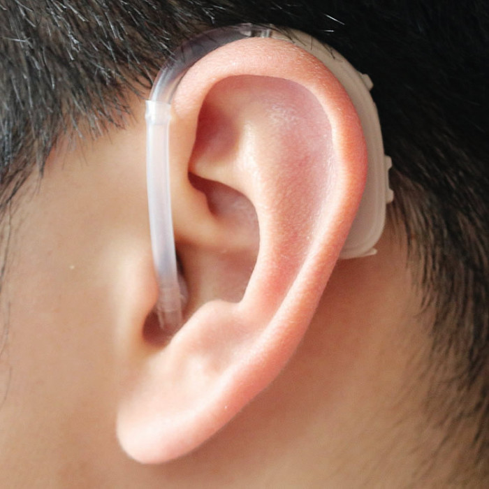 Aparat auditiv digital Audisound D-18 cu reglaj programabil sunet